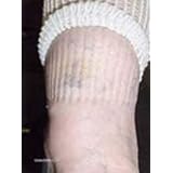 EdemaWear Open Toe 22” SM : Amazon.ca: Health & Personal Care