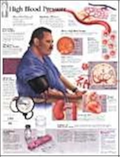 High Blood Pressure chart: Laminated Wall Chart in Kenya | Whizz Cardiology