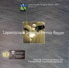 PDF⋙ Laparoscopic Inguinal Hernia Repair: Featuring Total Extraperitoneal and Transabdominal ...