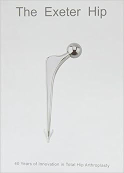 The Exeter Hip: 40 Years of Innovation in Total Hip Arthroplasty ...