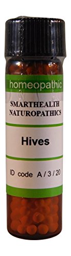 Hives Treatment Home Remedies | Natural Home Remedies For Hives