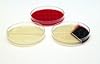Sabouraud Dextrose Agar Plates in Kuwait | Whizz Life Science Supplies