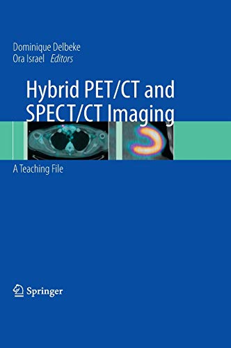 Hybrid PET/CT and SPECT/CT Imaging: A Teaching File: 9780387928197 ...