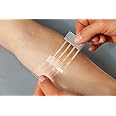 Amazon.com: Clozex Emergency Laceration Closures - Repair Wounds ...