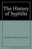 Pox: Genius, Madness, And The Mysteries Of Syphilis: Deborah Hayden ...