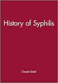 History of Syphilis: 9780745610306: Medicine & Health Science Books ...