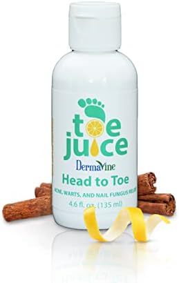 Toe Juice with DermaVine All-Natural Head to Toe Itchy Skin Relief ...