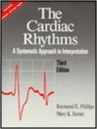 Buy The Cardiac Rhythms: A Systematic Approach to Interpretation Book ...