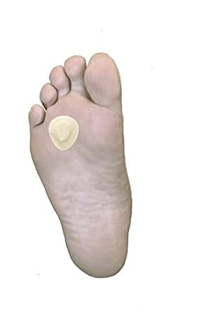 Morton's Neuroma Ball of Foot Pads, 100 Pack of Metatarsal Cushions ...