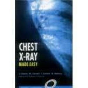 Chest X-Ray Made Easy: Professor John Moxham: 9780443070099: Amazon.com ...