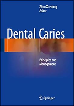Dental Caries: Principles and Management: 9783662474495: Medicine ...