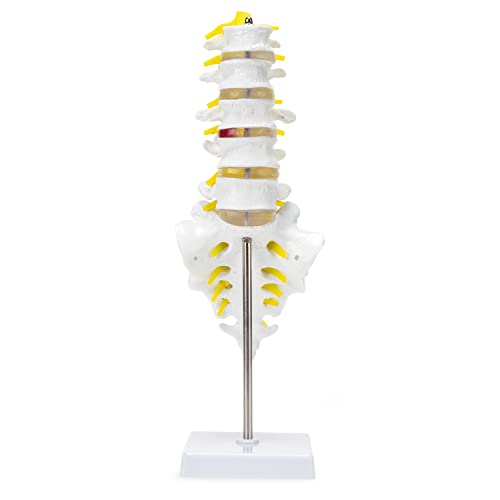 Mua Winyousk Model of The Lumbar Spine, Medical Anatomical Model of The ...