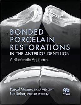 Bonded Porcelain Restorations in the Anterior Dentition: A Biomimetic ...