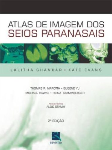 Atlas De Imagens Dos Seios Paranasais PDF Kate Evans, Lalitha Shankar
