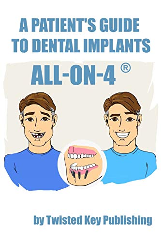 A Patient's Guide to Dental Implants: All-on-4: Publishing, Twisted Key ...