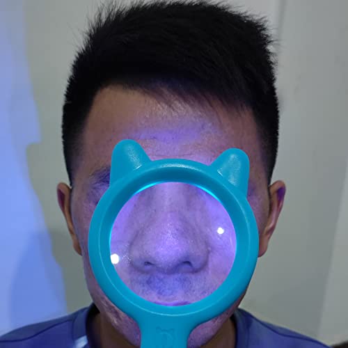 Woods Lamp Skin Analyzer Professional,Wood's Lamp Vitiligo Ringworm ...