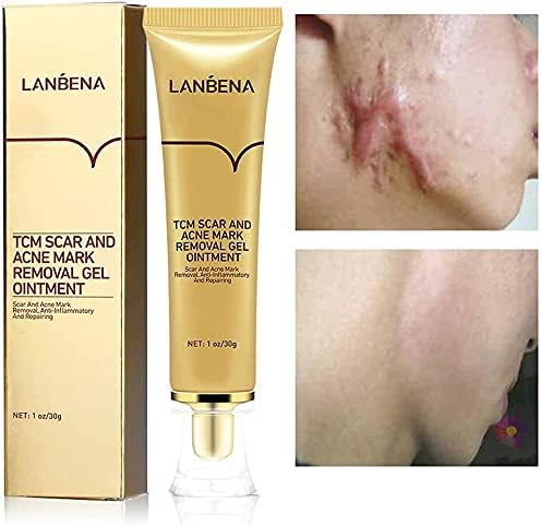 Tcm Scar and Acne Mark Removal Gel Ointment (30g) price in UAE | Amazon ...