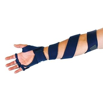 Amazon.com: Benik Tunnel Splint Supinator Strap: Industrial & Scientific