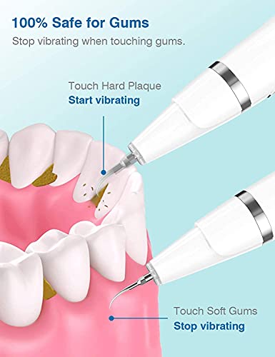 Plaque Remover for Teeth, Tooth Cleaner Tartar Remover, Electric Teeth ...