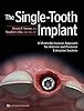 The Single-Tooth Implant: A Minimally Invasive Approach for Anterior ...