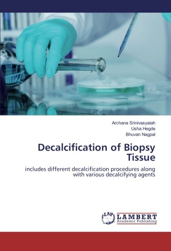 Decalcification of Biopsy Tissue: includes different decalcification ...