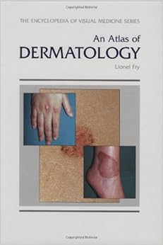 An Atlas of Dermatology: 9781850704614: Medicine & Health Science Books ...