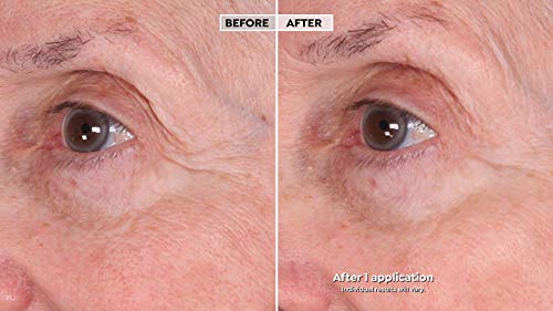 NassifMD Quickfix Face and Neck Lift Mask - Retinol Peel Off Face Mask ...