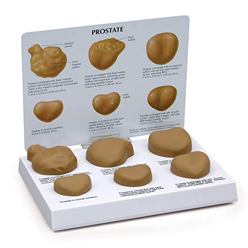 Prostate Model Set | Human Body Anatomy Replica of Prostates w ...