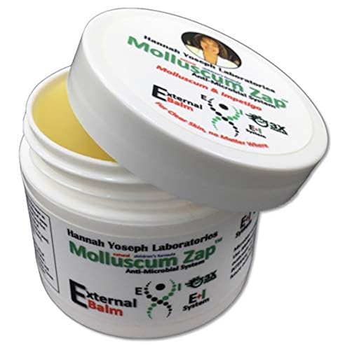 Molluscum Contagiosum Treatment Cream: for Molluscum, Impetigo, Diaper ...