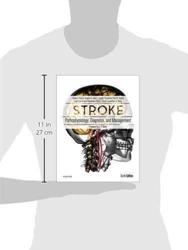 Stroke: Pathophysiology, Diagnosis, and Management | Pricepulse