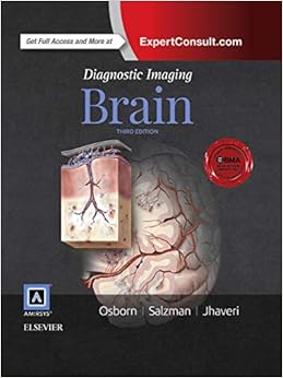 Amazon.fr - Diagnostic Imaging: Brain - Osborn MD FACR, Anne G ...
