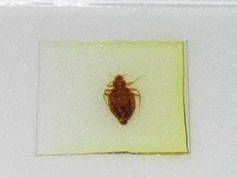 Bed Bug w.m Prepared Slide for Microscope: Amazon.com: Industrial ...