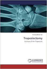 Trapeziectomy: Excision of the Trapezium: Iyer, Krishna Mohan ...