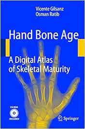 Hand Bone Age: A Digital Atlas of Skeletal Maturity: Gilsanz, Vicente ...