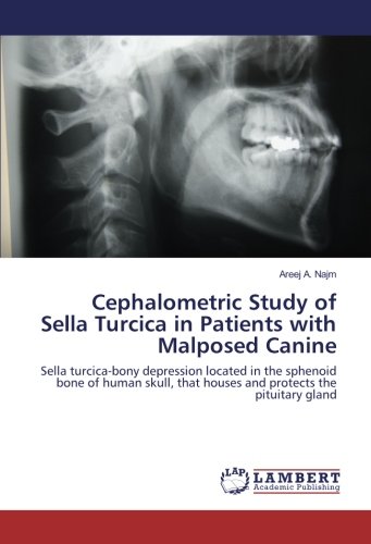 Buy Cephalometric Study of Sella Turcica in Patients with Malposed ...
