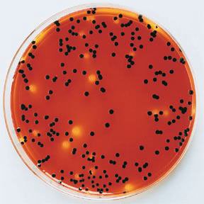 Amazon.com: BD Diagnostic 211825 Bacto Tryptic Soy Broth, 500 g ...