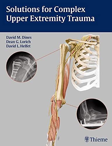 Solutions for Complex Upper Extremity Trauma: 9781588905048: Medicine ...