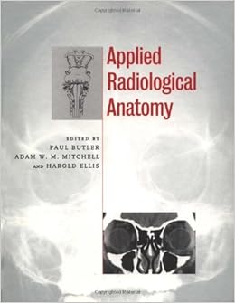 Applied Radiological Anatomy: 9780521481106: Medicine & Health Science ...