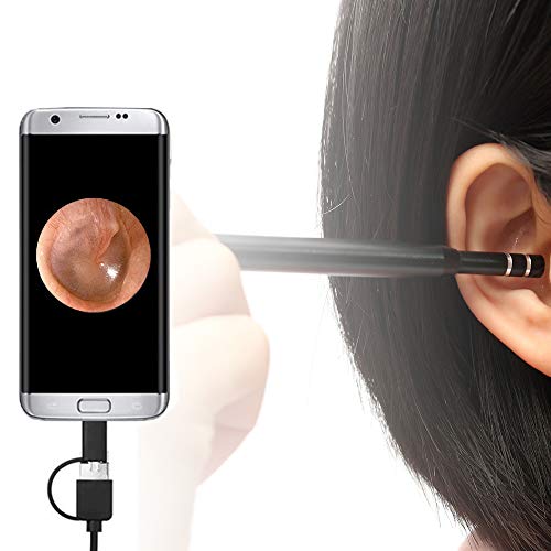 Ear Scope Camera-USB Otoscope, Visual Ear Camera HD Ear Endoscope with ...