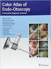 Color Atlas of Endo-Otoscopy: Examination-Diagnosis-Treatment ...