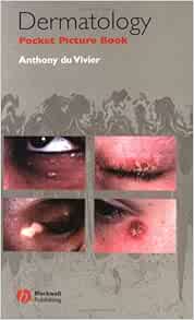 Dermatology Pocket Picture Book: 9780632054282: Medicine & Health ...