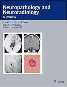 Neuropathology and Neuroradiology: A Review: 9781588900555: Medicine & Health Science Books ...