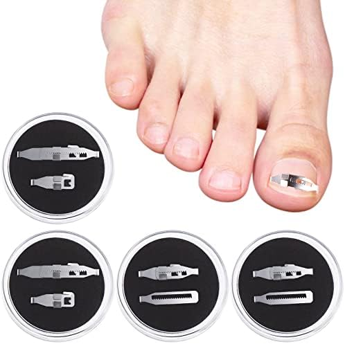 Ingrown Straightening Clips Toenail Pedicure Tool Curved Brace Toenails ...