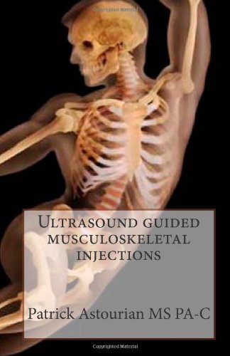 Ultrasound guided musculoskeletal injections: 9781456574208: Amazon.com ...