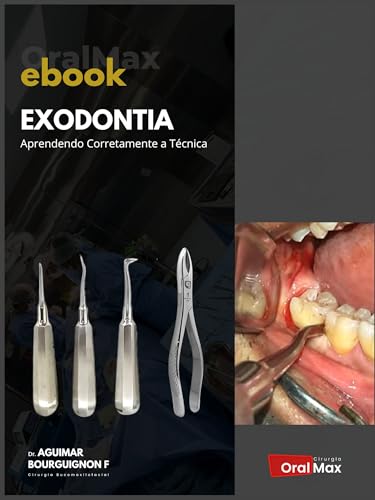 Exodontia. Aprendendo Corretamente a Técnica - eBook, Resumo, Ler ...