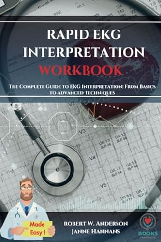 RAPID EKG INTERPRETATION: The Complete Guide to EKG Interpretation ...