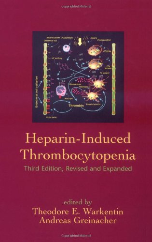 Heparin-Induced Thrombocytopenia (Fundamental and Clinical - Import It All