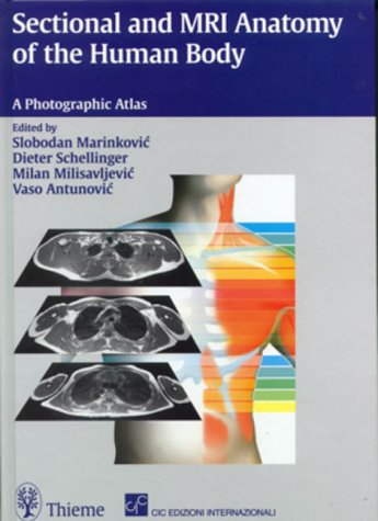 Sectional and MRI Anatomy of the Human Body: A Photographic Atlas ...