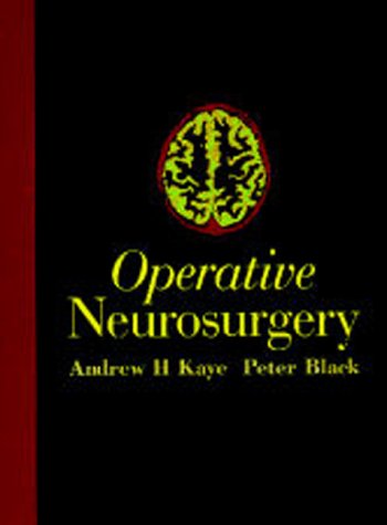 Amazon - Operative Neurosurgery: 2-Volume Set: Kaye MB BS MD FRACS ...