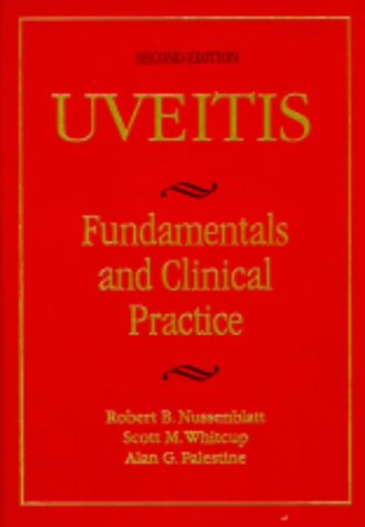 Uveitis: Fundamentals in Clinical Practice: 9780815164463: Medicine ...